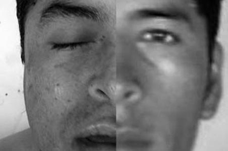 El Cadáver del Lazca Sale Sin Orejas En Las Fotos Porque Se Las Operó ...