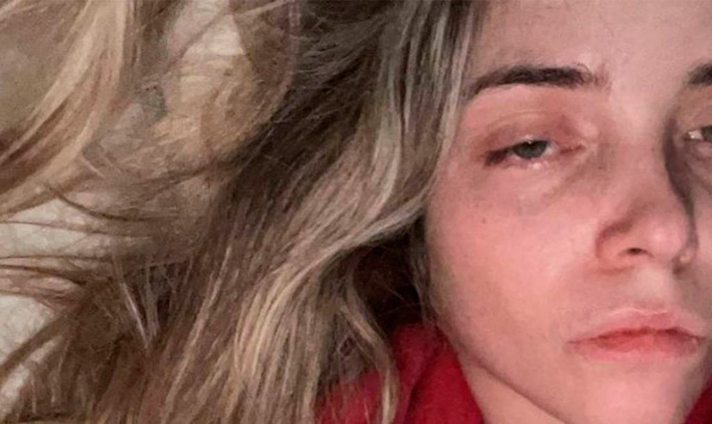 Minnie West, Decide Internarse En Hospital Psiquiátrico Tras La Muerte ...